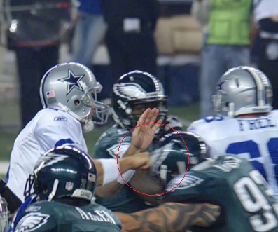 Tony Romo's Hand Injury Looks Really Bad ... but He Says He'll Be Good ...