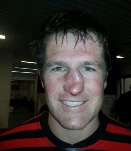 Rugby player Ernst Joubert suffers horrible broken nose (Picture)
