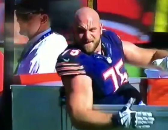 Kyle Long tweets nasty photo of his ankle injury | Larry Brown Sports