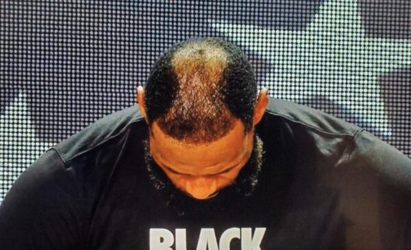 LeBron James mocked over his receding hair