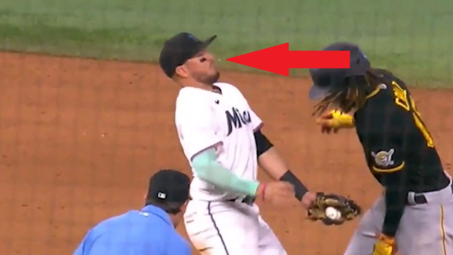 Marlins' Miguel Rojas loses tooth mid-game in strange collision