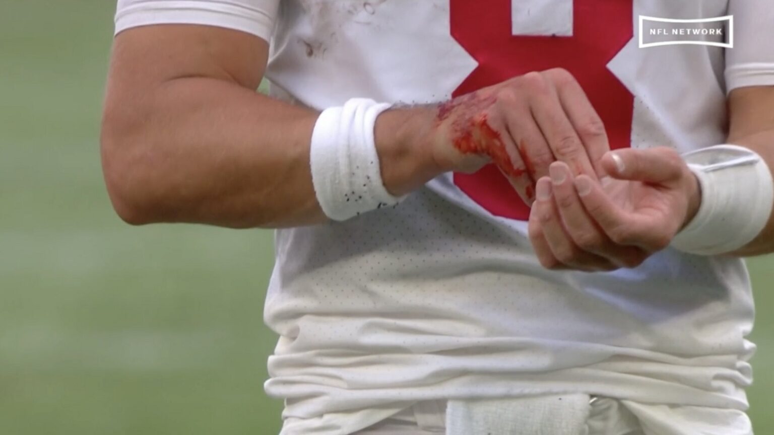 Daniel Jones played through bloody injury in fourth quarter comeback