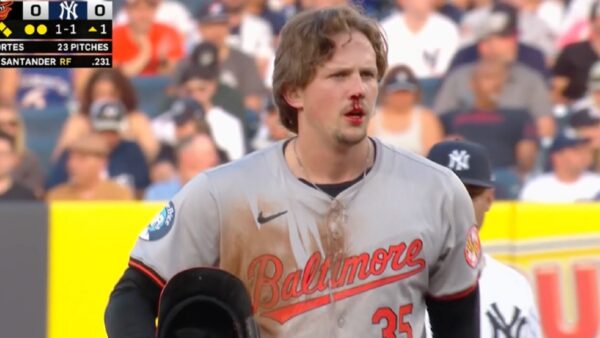 Adley Rutschman suffers bloody nose diving into second base on pickoff ...