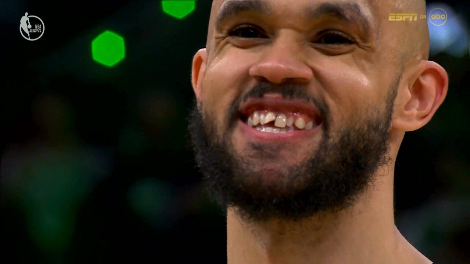 Derrick White suffers chipped tooth during Game 5