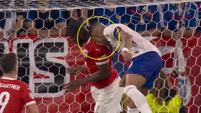 Kylian Mbappe to undergo surgery after scary collision against Austria ...