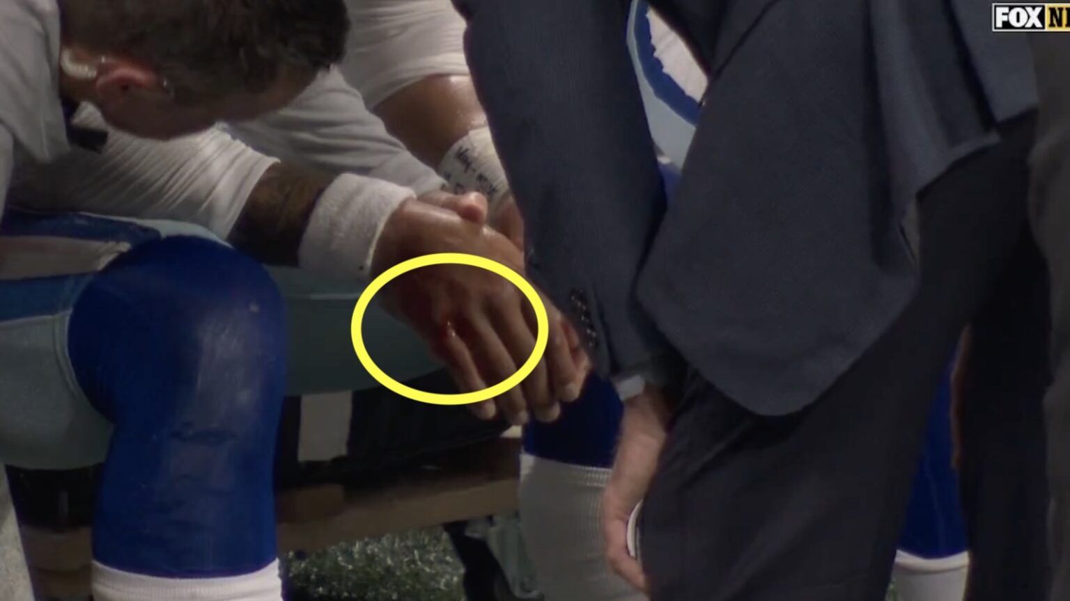Dak Prescott suffers hamstring, hand injuries in Week 9
